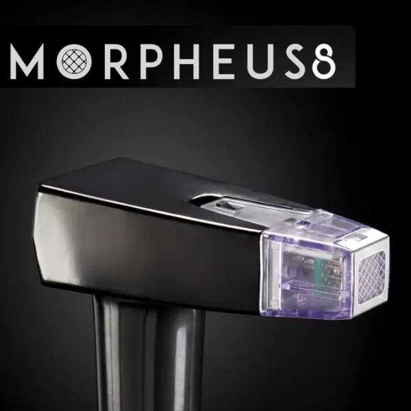 Morpheus8 Microneedling | Albany Laser Centre Edmonton